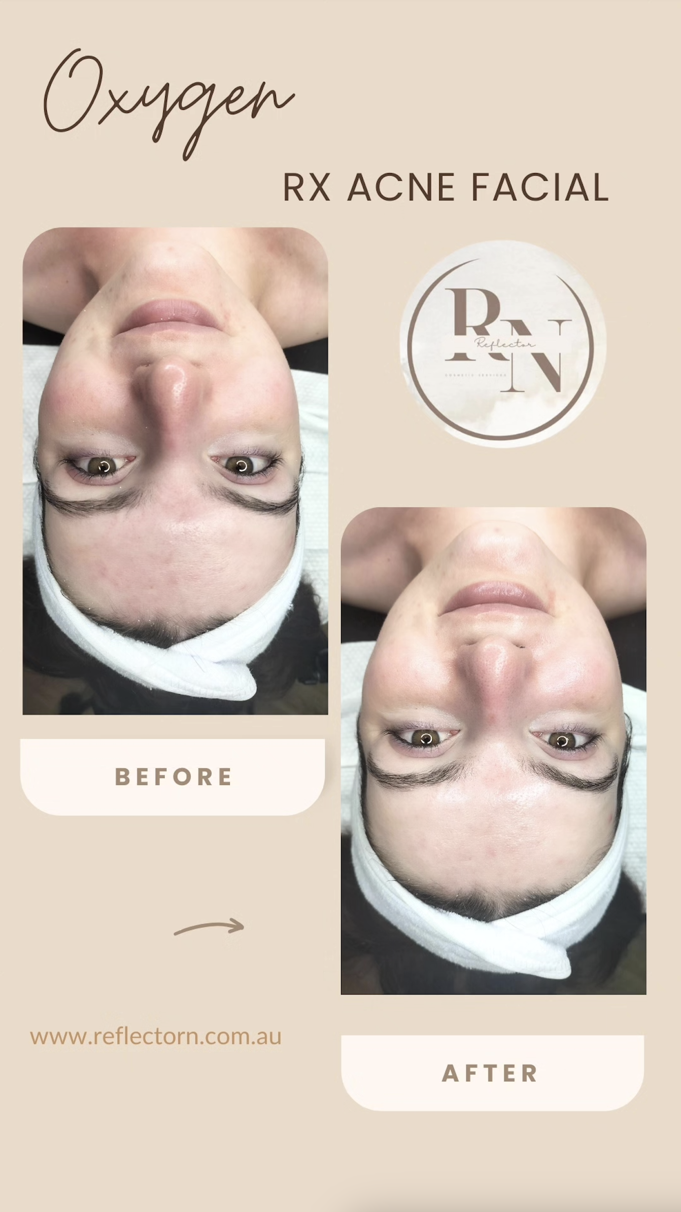 Glow From Within: Experience Circadia Facials at ReflectorN